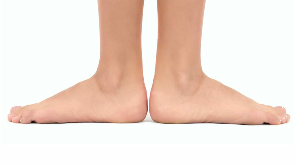 Ketahui Fakta Menarik Seputar Flaat Foot - Berita Seleb & Lifestyle