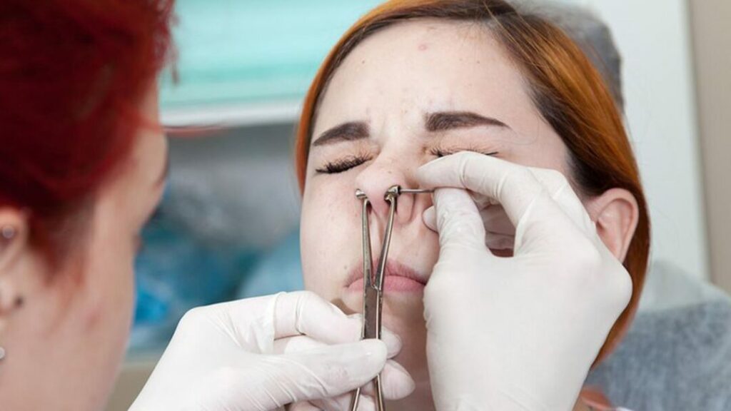 Tertarik Tindik Hidung? Ketahui Beberapa Hal Ini Sebelum Melakukannya ...